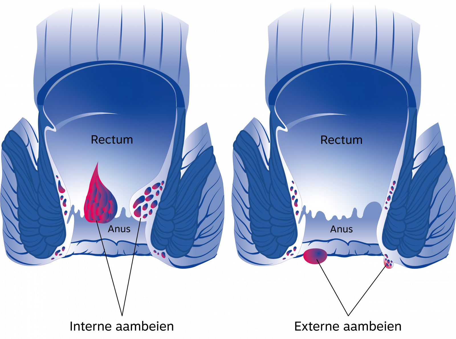 Proctologie (anale klachten) - DC Klinieken